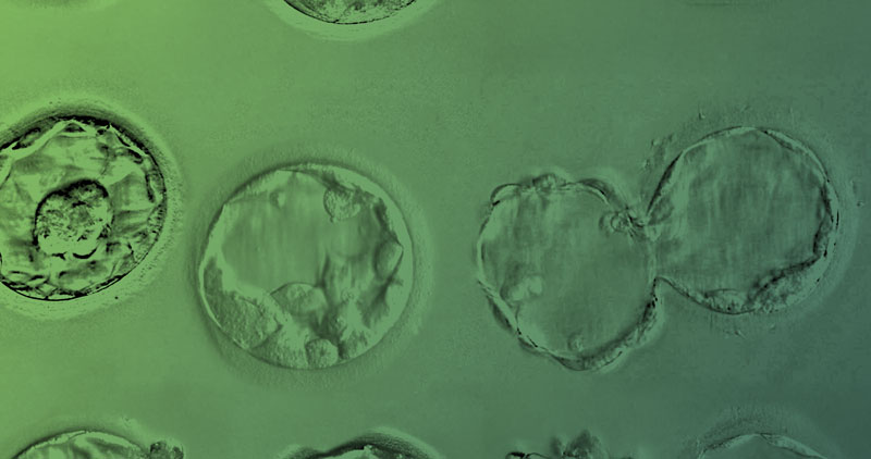 Publikationen | green-ivf | Kinderwunsch-Zentrum in NRW